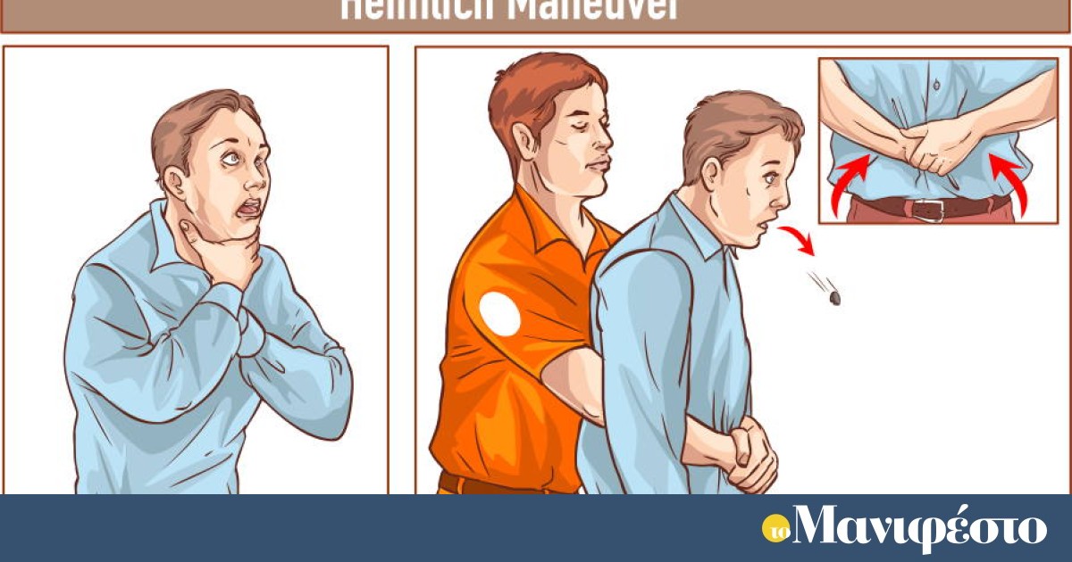 Mέθοδος Heimlich: Ποια είναι η λαβή που όλοι πρέπει να γνωρίζουμε και ...